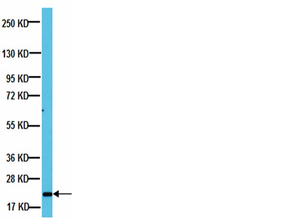 Anti-ARF1 Antibody, clone 3F1 | 05-1427